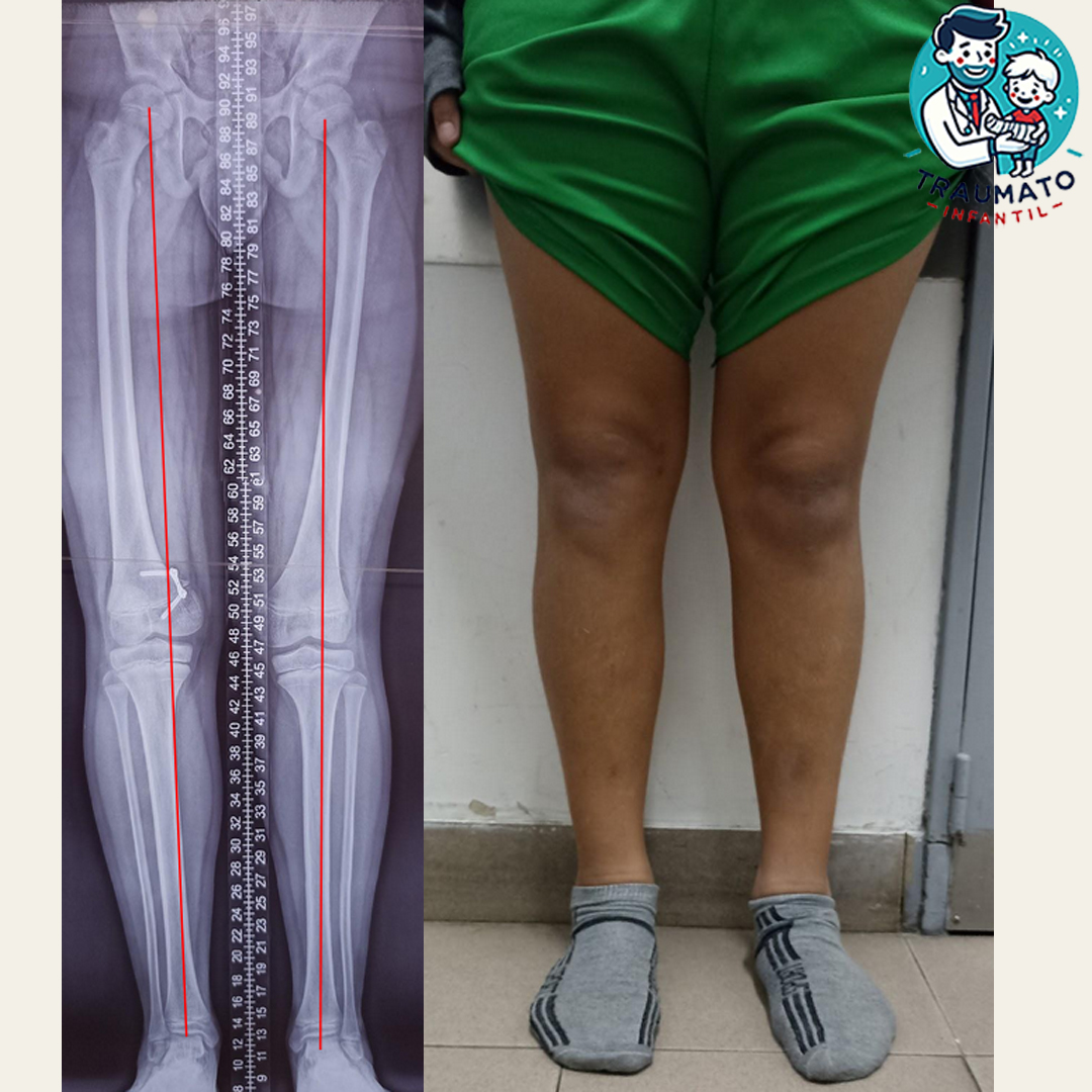 Traumatologia infantil • Turno en Buenos Aires de traumatologia infantil